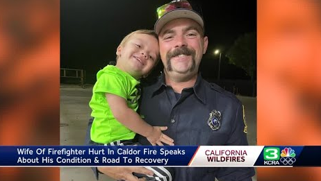 Severely Burned CA Firefighter Receives Skin Grafts | Firehouse